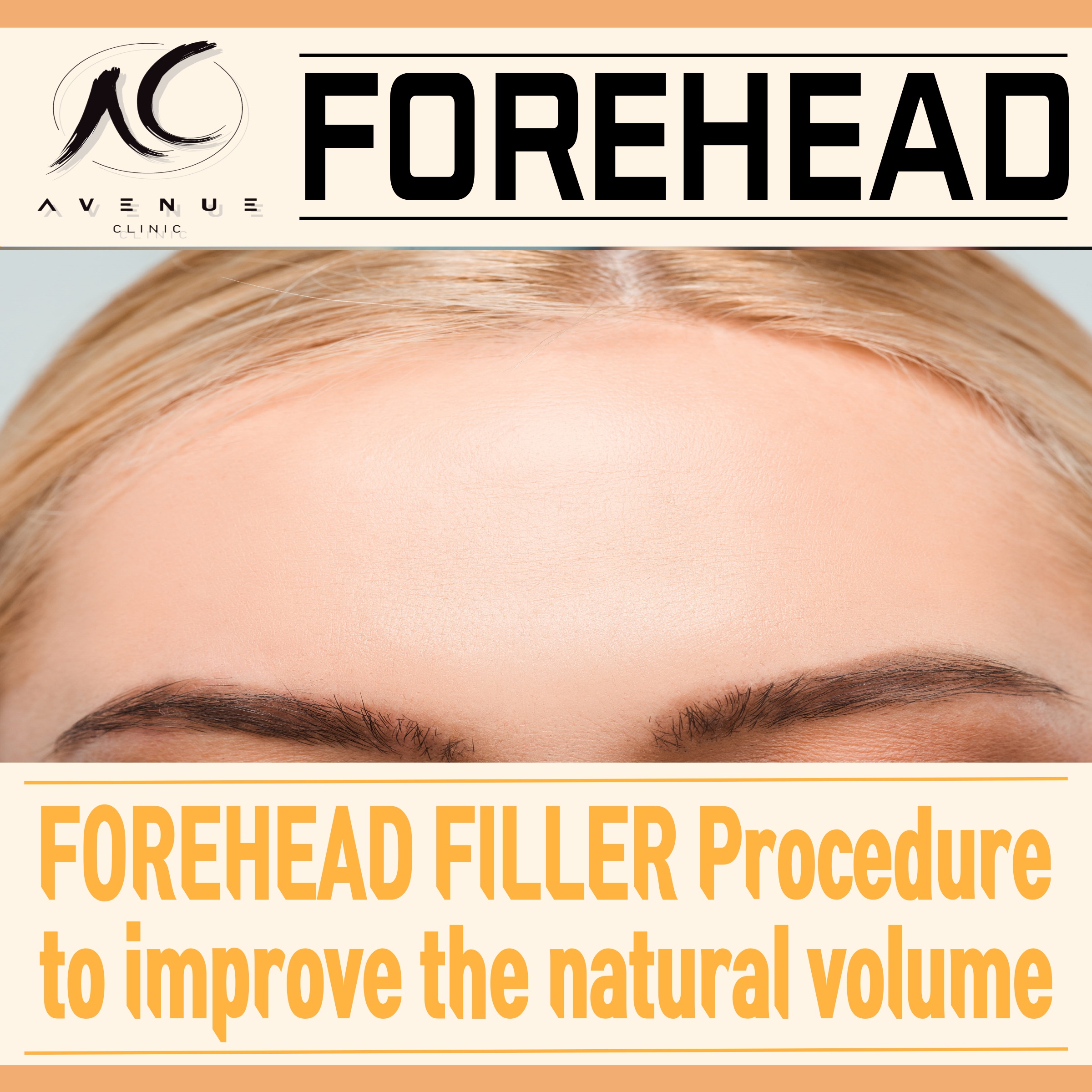 FOREHEAD FILLER - AVENUE CLINIC PYEONGTAEK | NEAR BY USAG Humphreys(K-6 ...
