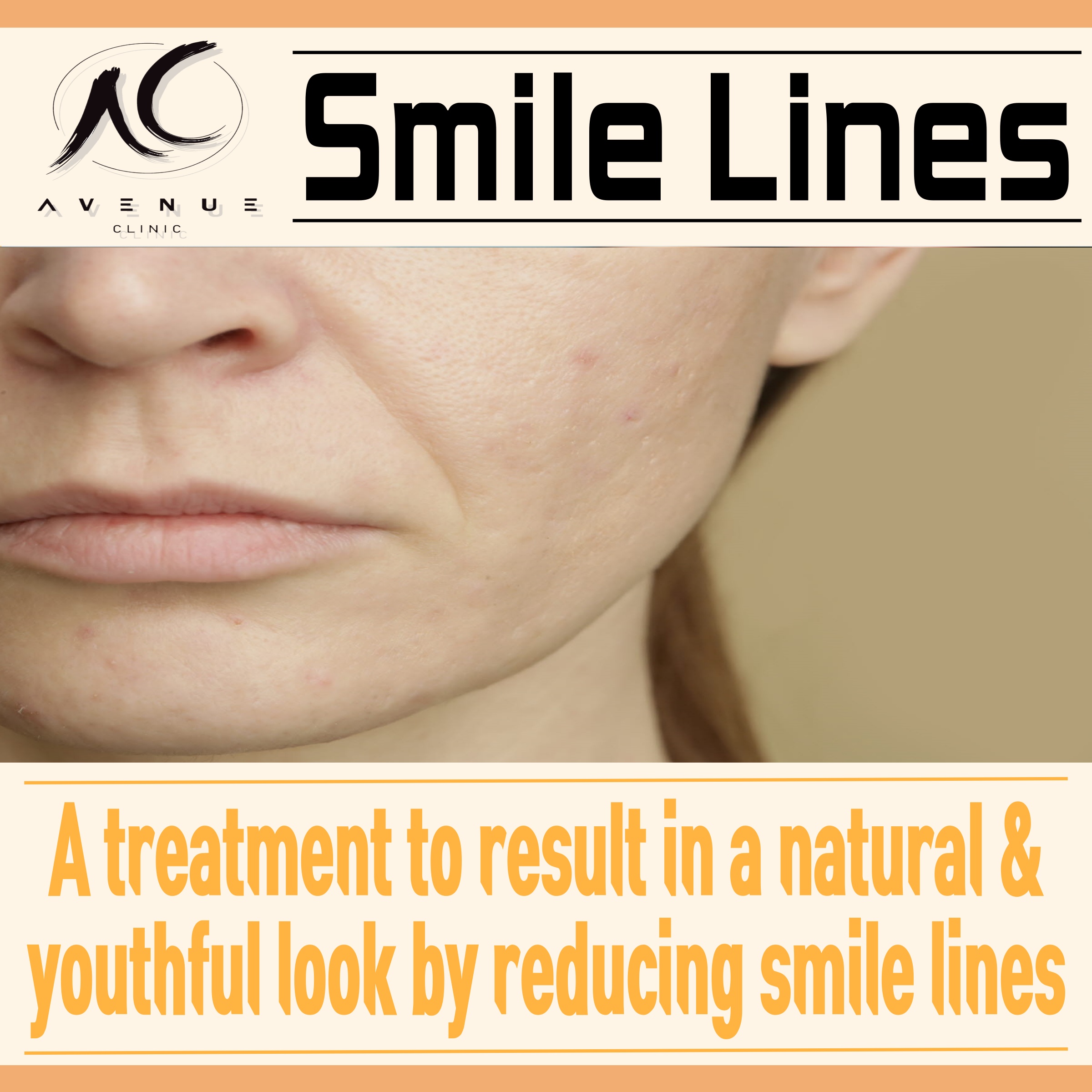 SMILE LINES - AVENUE CLINIC PYEONGTAEK | NEAR BY USAG Humphreys(K-6 ...